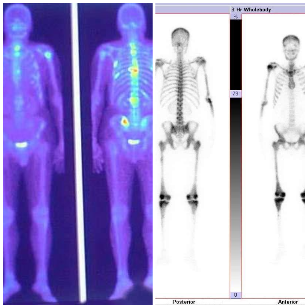 Services Offered - Gamma Imaging Center